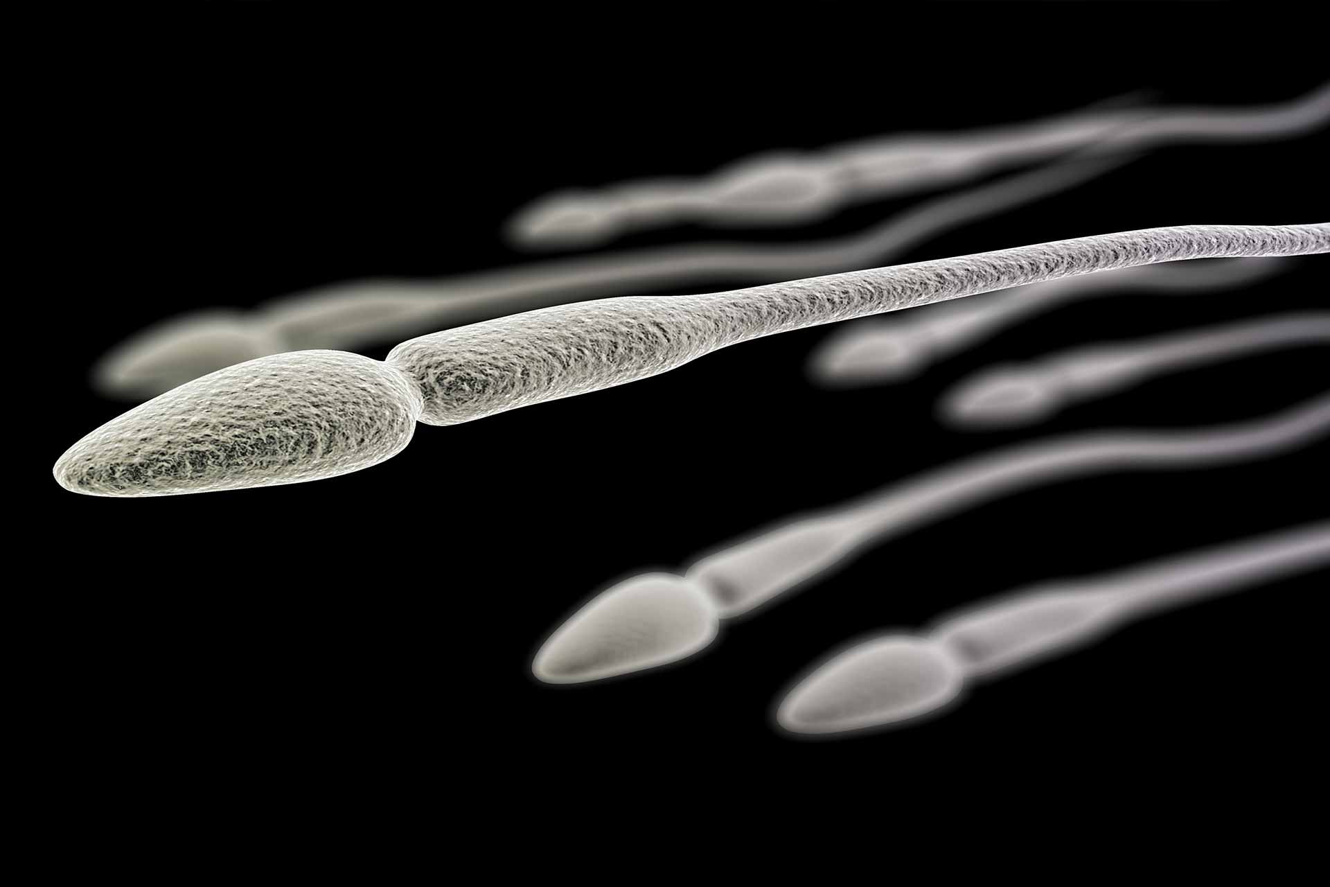 Basic semen analysis course by ESHRE - Eργαστήριο Ανδρολογίας Ζεγκινιάδου